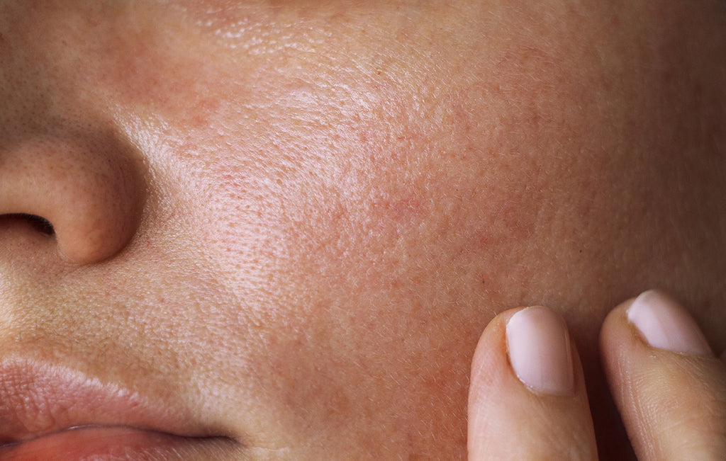 Preventing Common Skin Conditions Like A Boss | Causes and Treatments